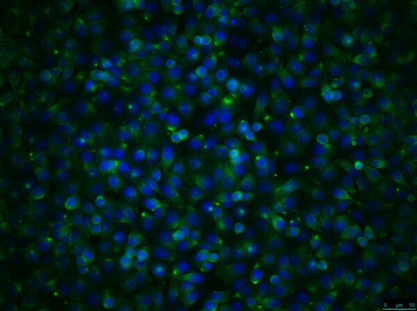 T24T Human Bladder Carcinoma Cell Line | SCC468